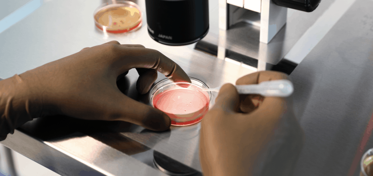 IVF or Test Tube Baby Treatment & Embryo Transfer | Anmol IVF